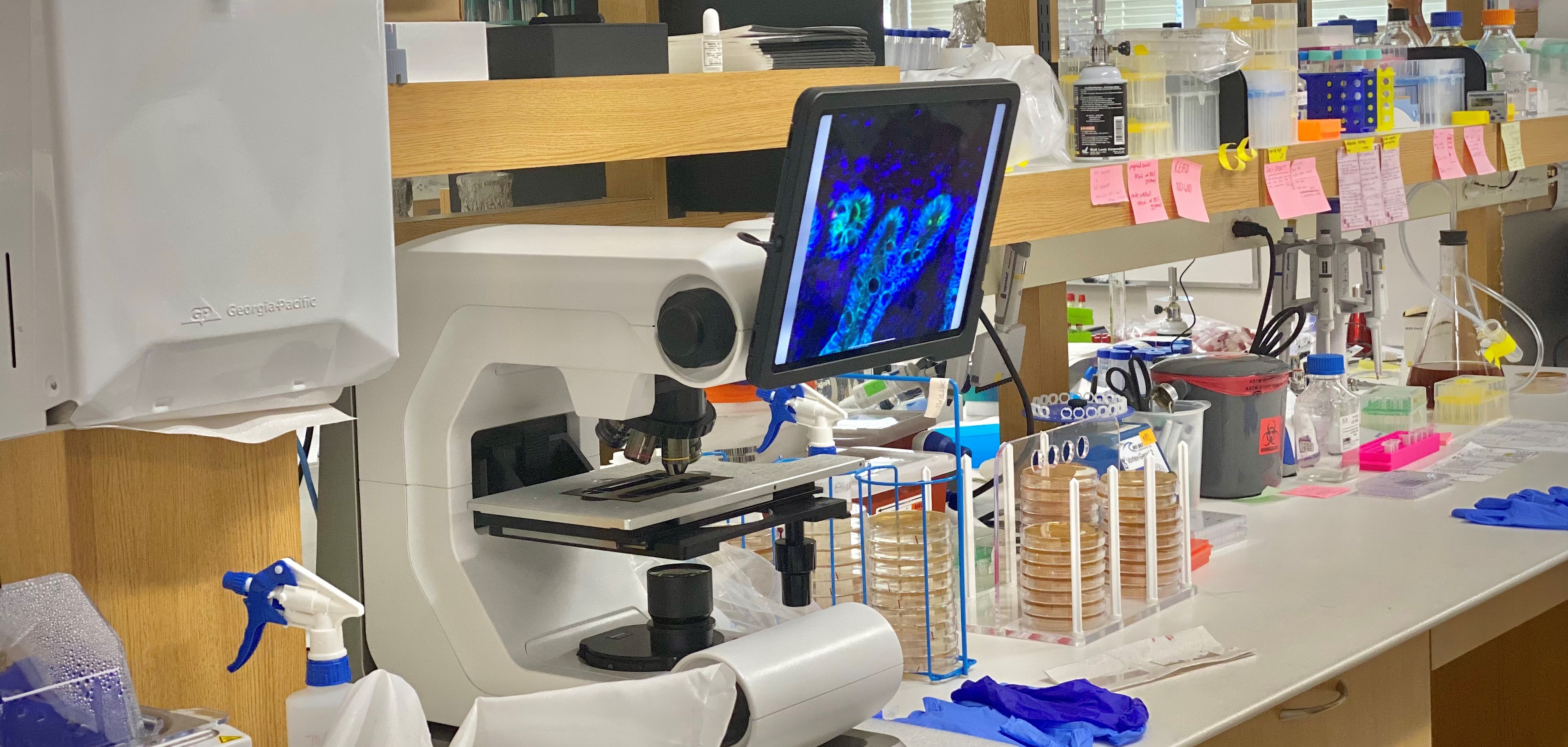 ERR-gamma ‘trains’ stomach stem cells to become acid-producing cells | BCM